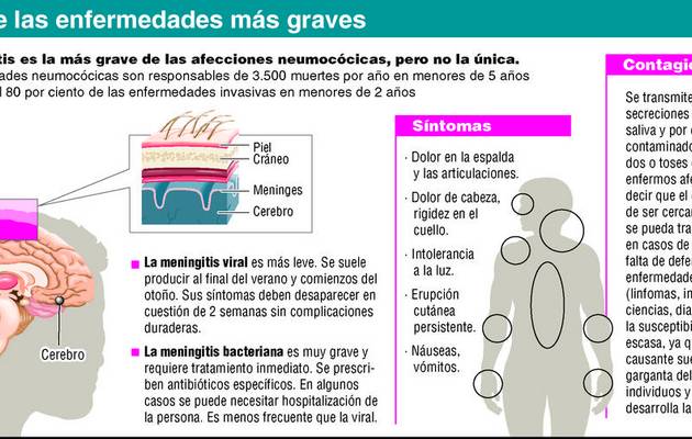 Meningitis: advierten que es clave reconocer los síntomas - Información ...
